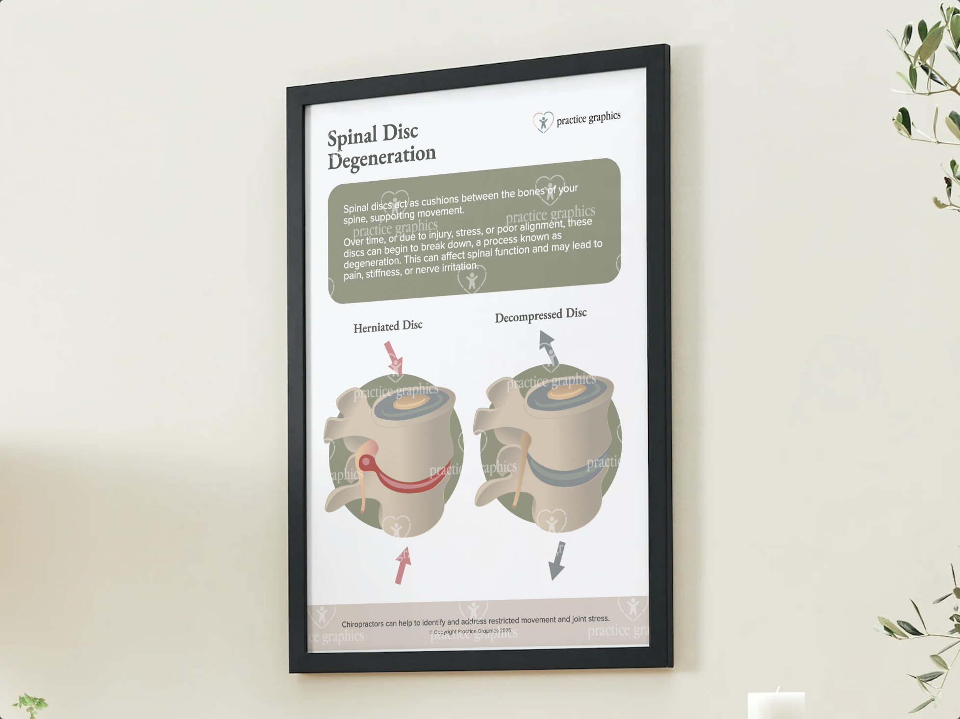 Spinal disc degeneration Poster – Practice Graphics
